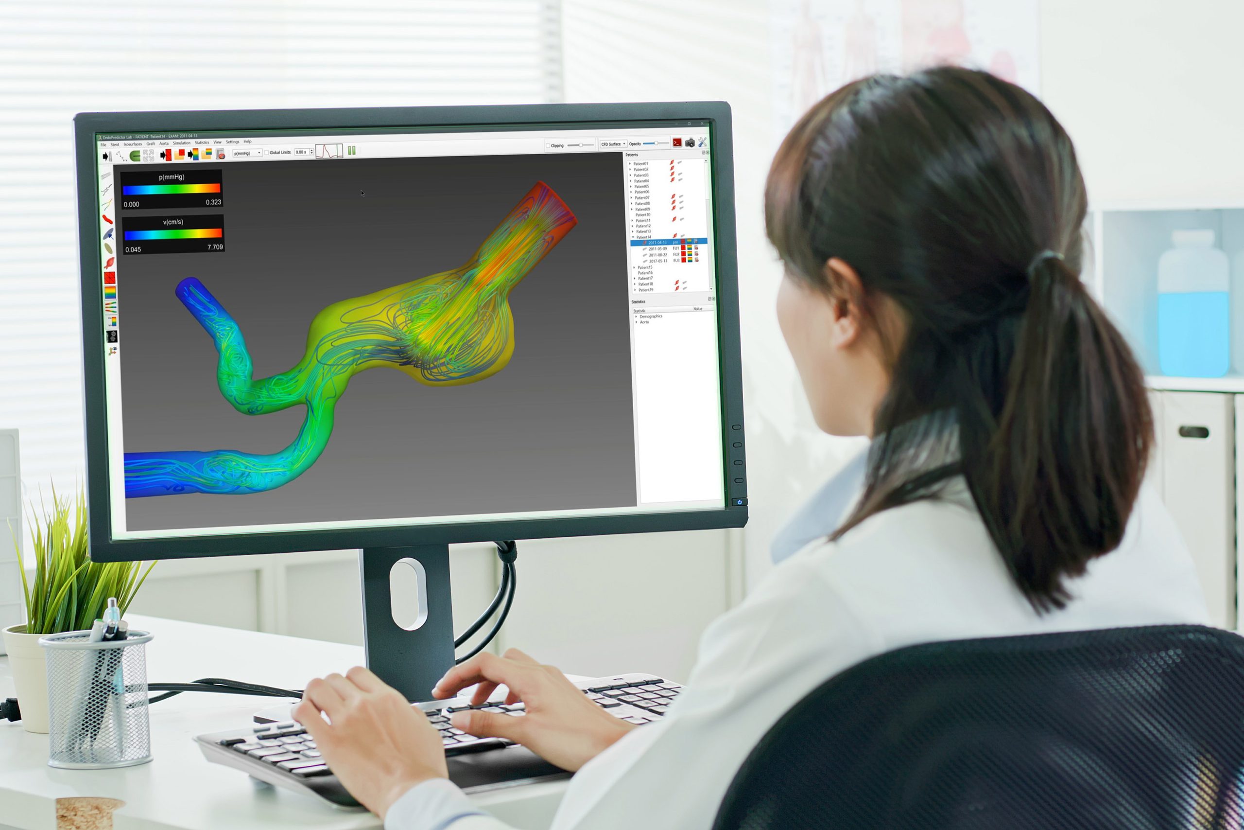 Automatic image segmentation of the abdominal aorta and stent grafts using artificial ...
